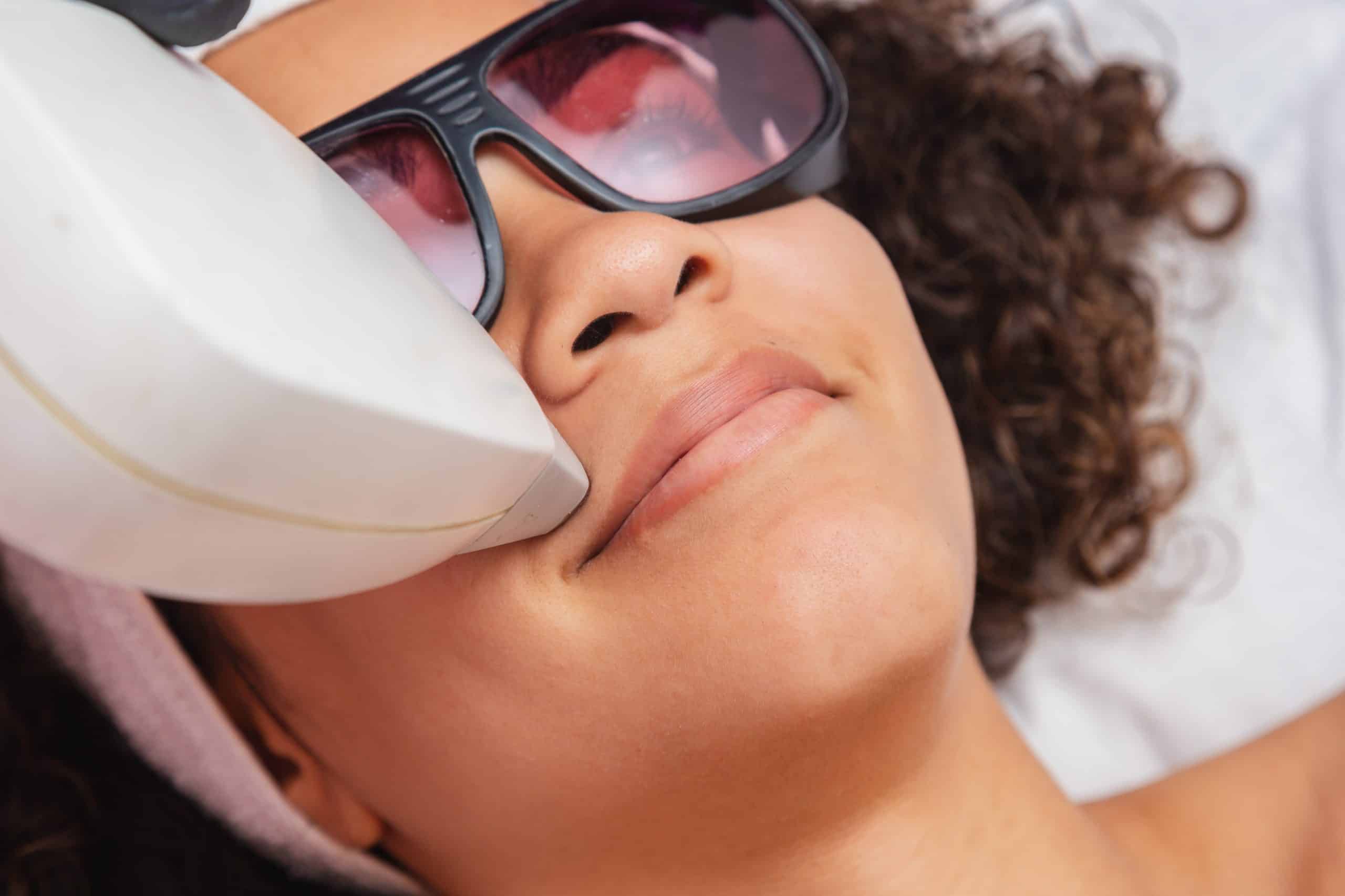 Tout savoir sur l'épilation laser du visage à Paris : un guide complet